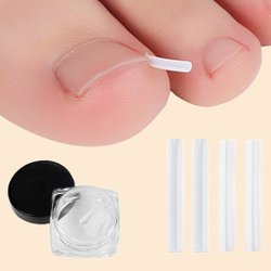 파고드는 내향성발톱 관리 10P+케이스 SET 고정 팁 - SSG.COM